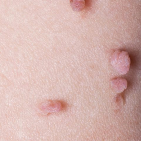 The Cheshire Aeshetic Clinic Chester | Skincare Treatments, Laser Hair Removal, Inch Loss and ...